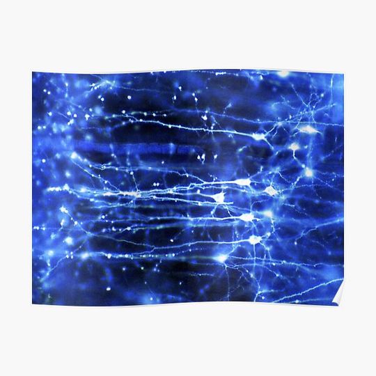 Human Brain Synapses Electron Microscope Photo Premium Matte Vertical ...